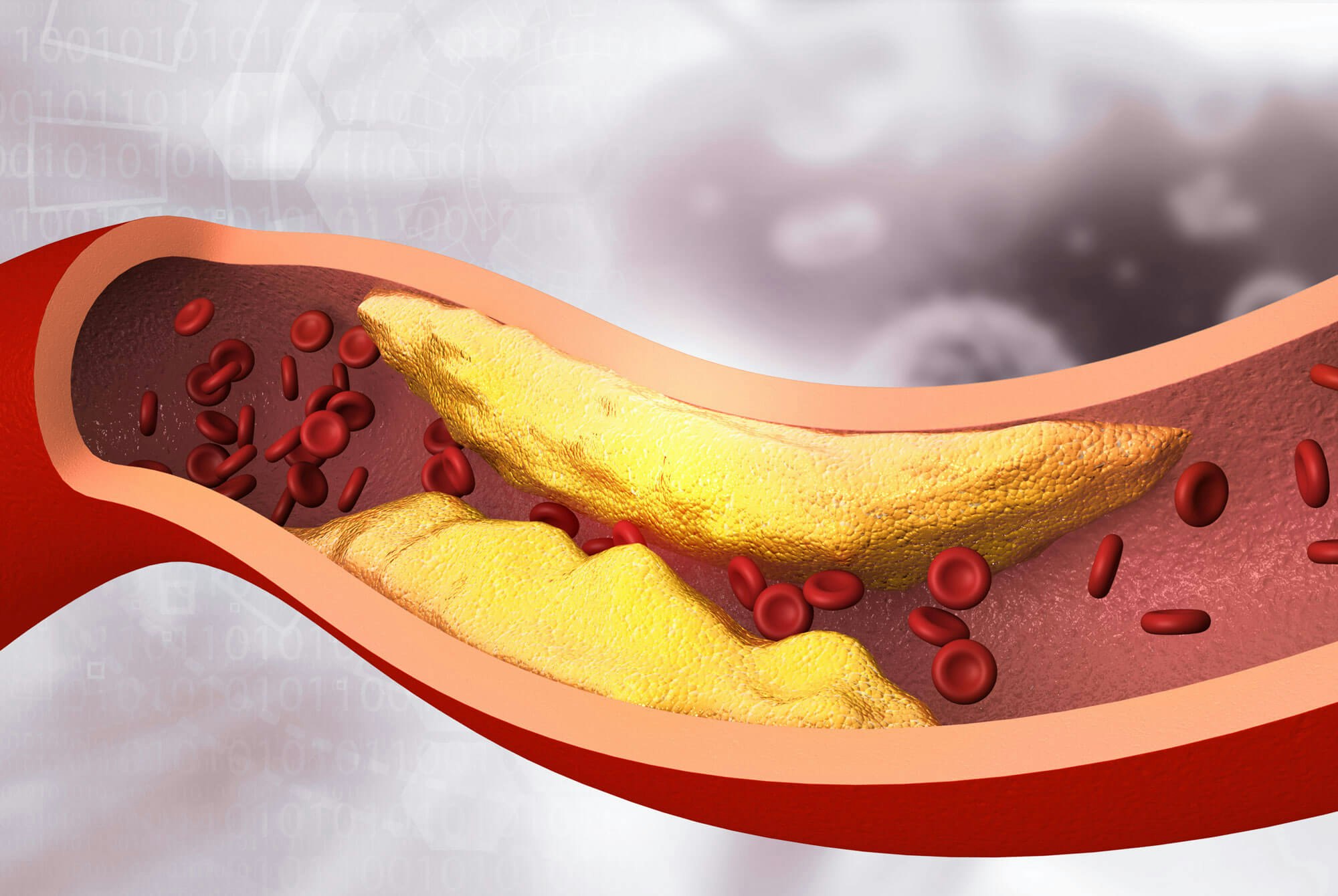 Kolesteroli hallintaan – enemmän hyvää ja vähemmän huonoa kolesterolia ...