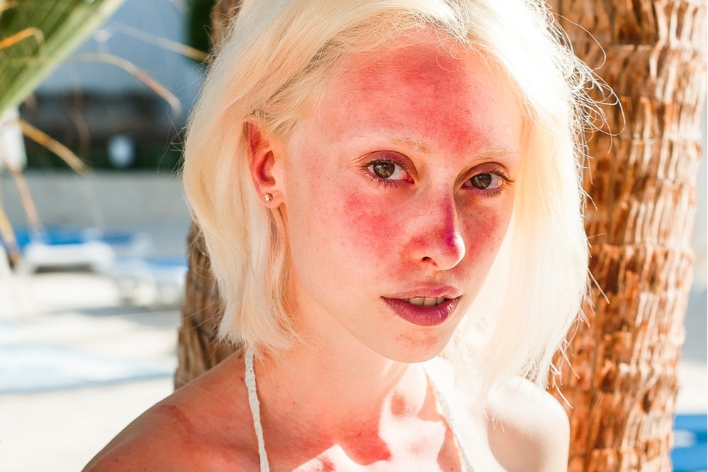 Den biologiske forklaringen på vampyrisme | illvit.no