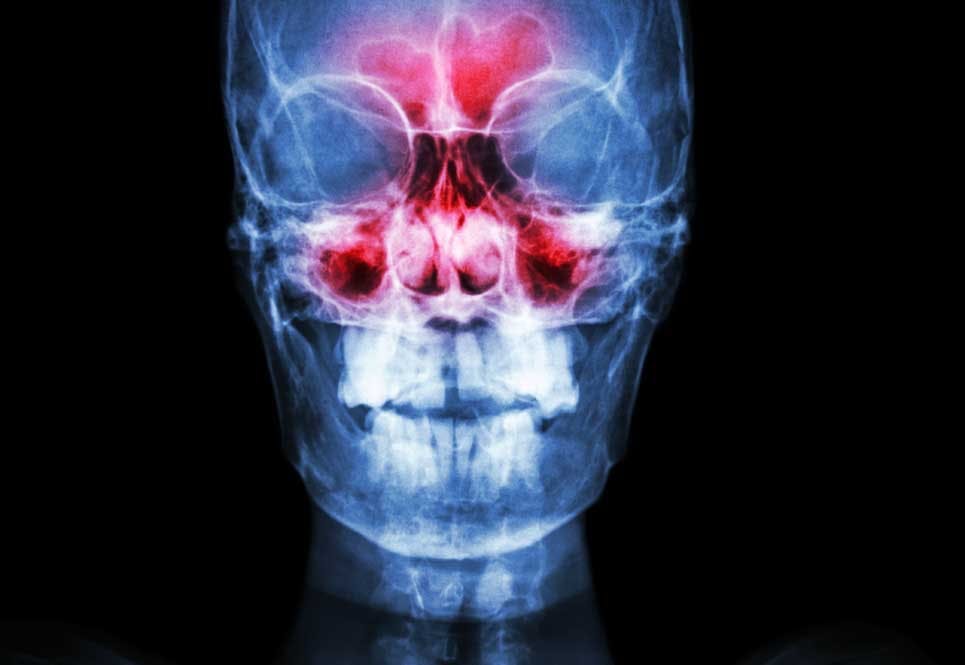 Vilken funktion har bihålorna? | illvet.se