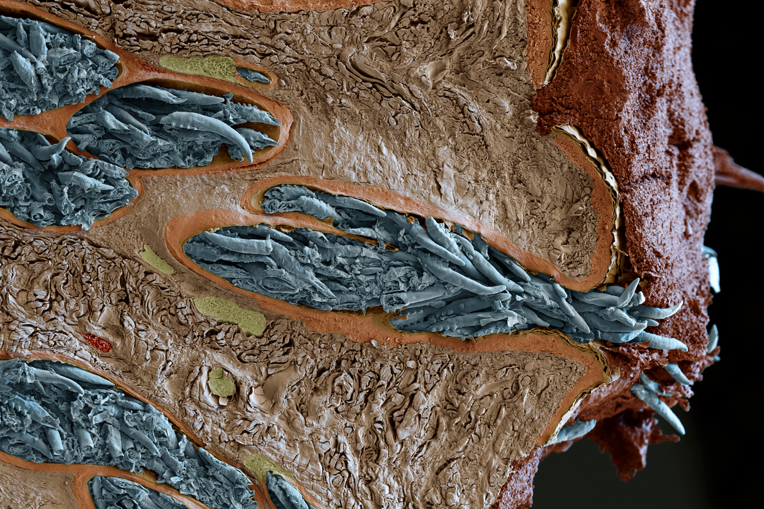 7 parasites that feed on your body | scienceillustrated.com