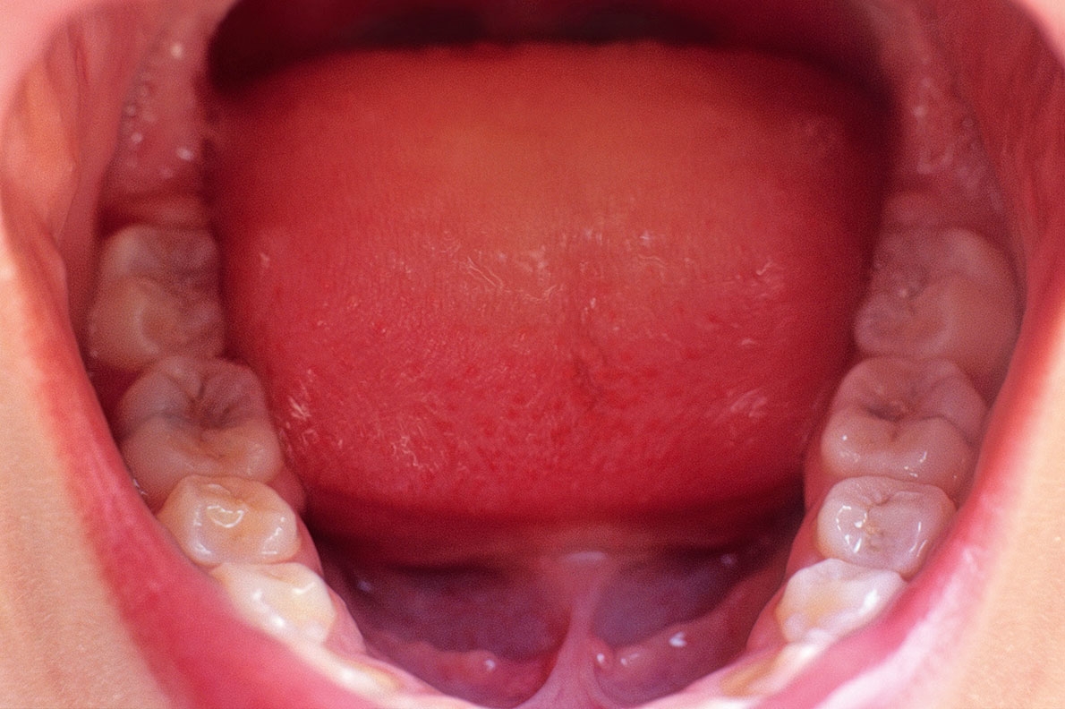 Waarom slissen sommige mensen? | wibnet.nl