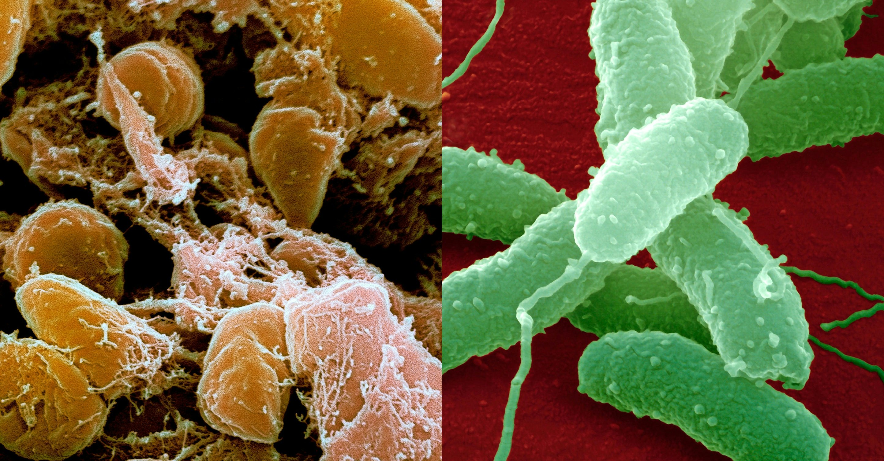 Wat is eigenlijk het ergste: pest of cholera? | wibnet.nl