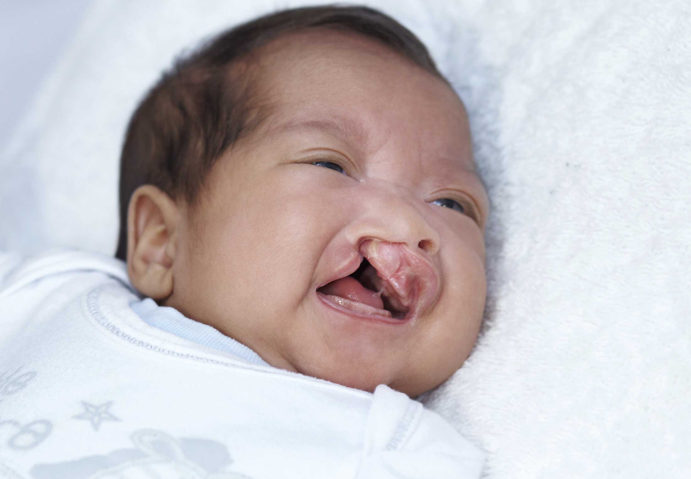 Zo ontstaat een schisis | wibnet.nl