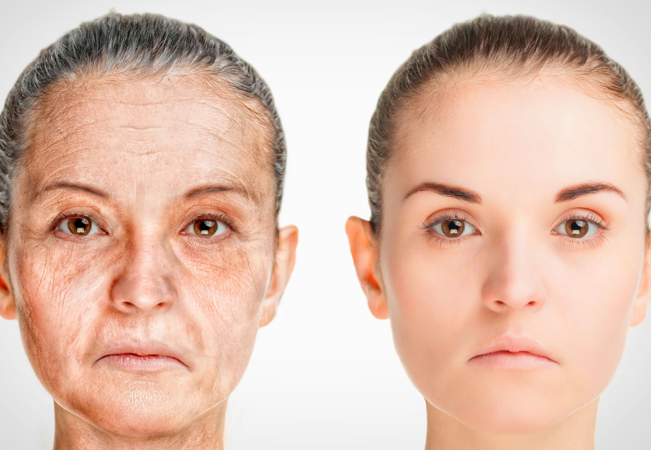 Onderzoekers verjongen menselijke huidcellen met 30 jaar | wibnet.nl