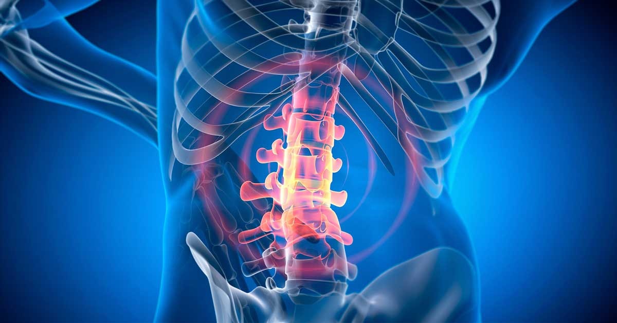 A 100 minute walk could reduce the risk of loin pain ...