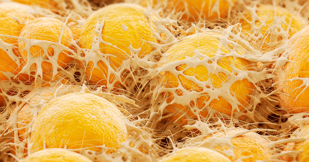 Excess weight makes fat cells remember the condition ...