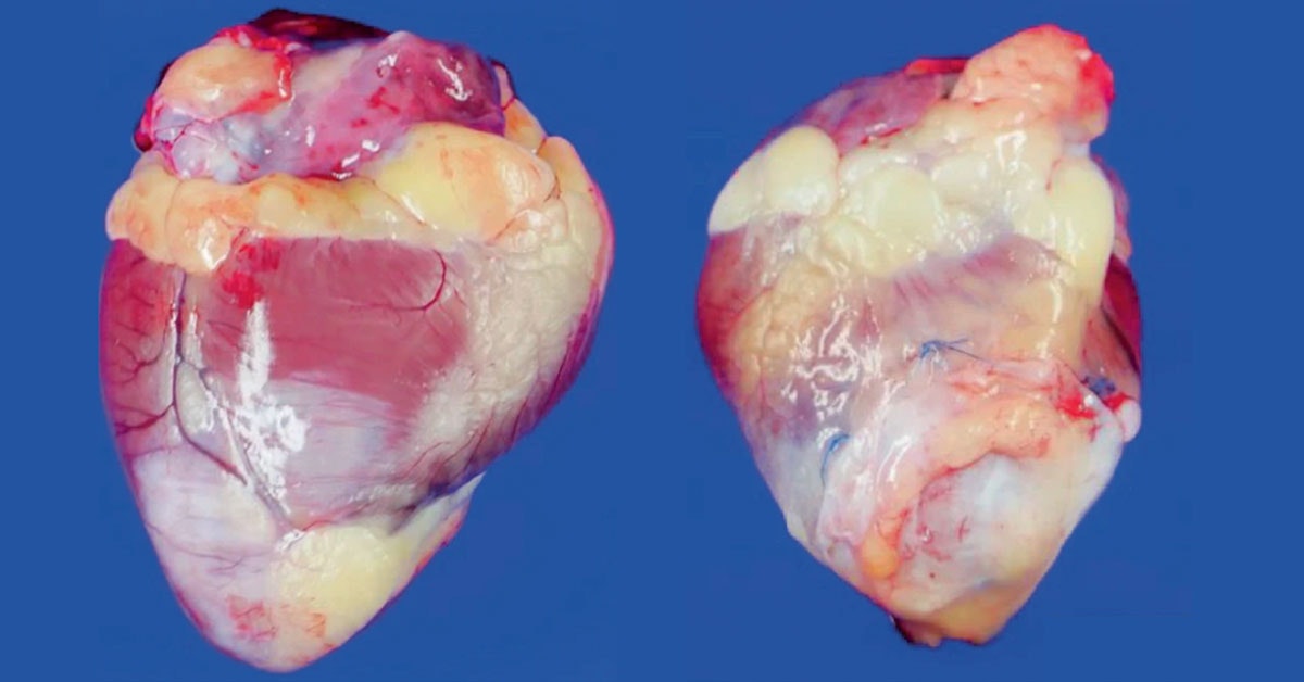 Sådan kan det beskytte hjertet at bo i grønne omgivelser | illvid.dk