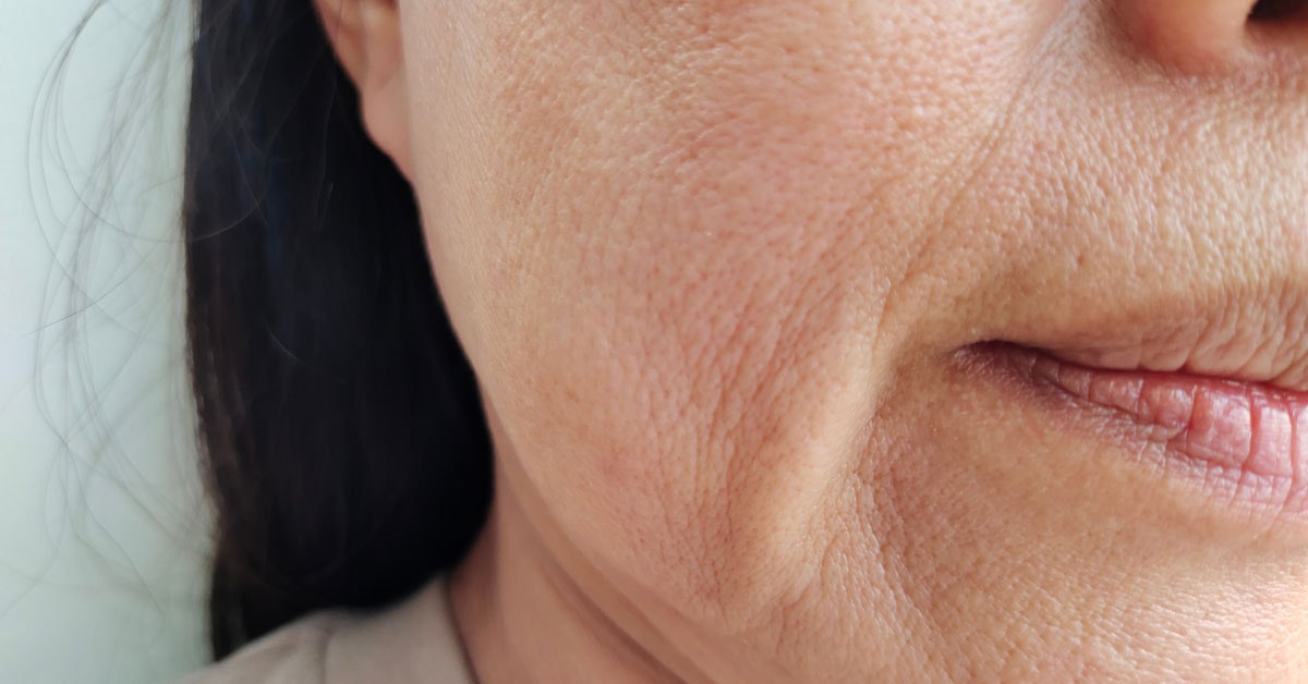 Breakthrough in skin research could help slow signs of ageing and ...