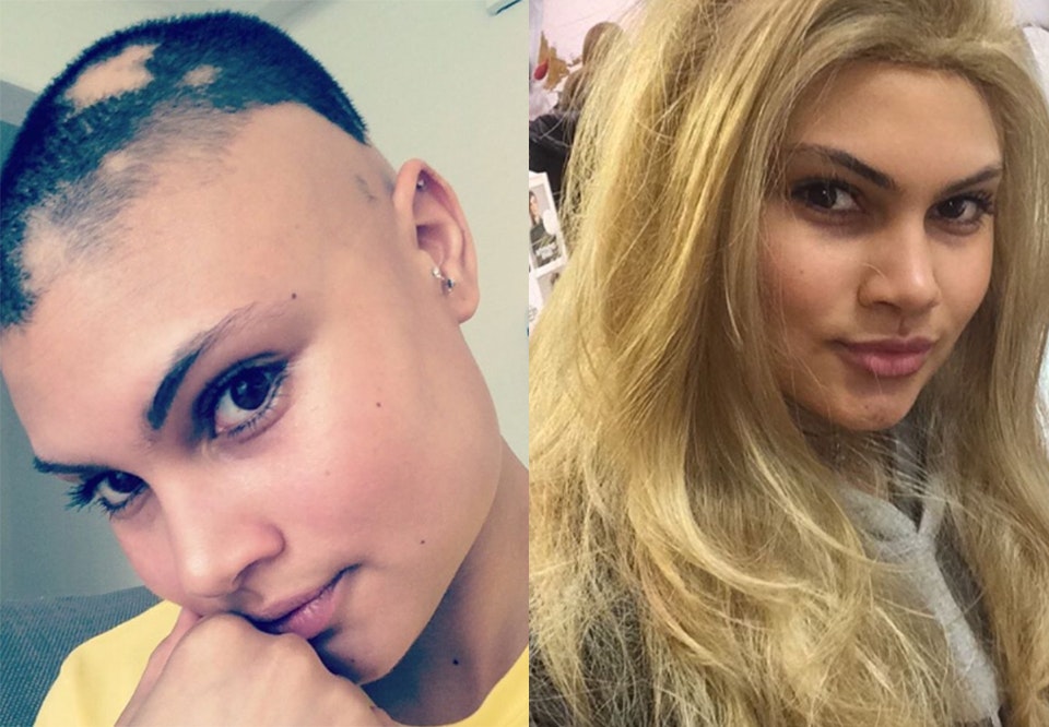 Modig kvinde med hårtab overvinder sin frygt og deler inspirerende ...